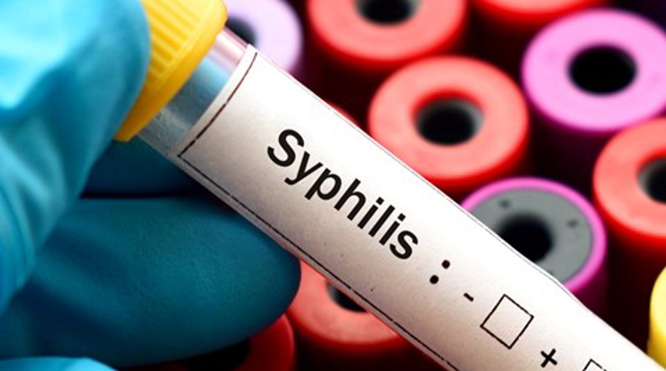 ESR data shows congenital syphilis on the rise and ongoing inequities ...